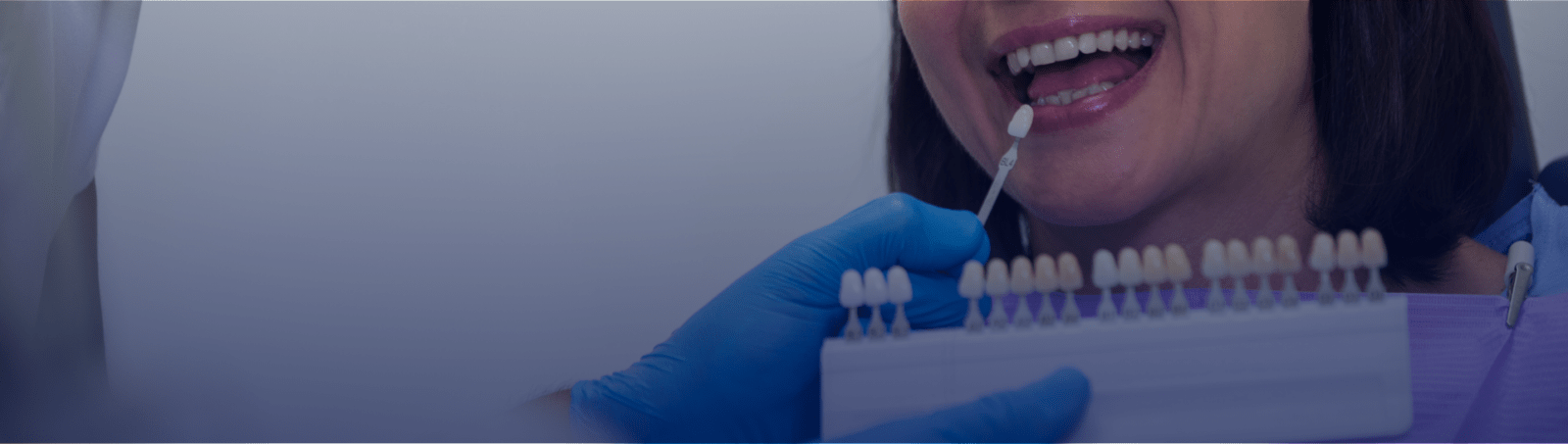 Smile Correction Treatment In Navi Mumbai